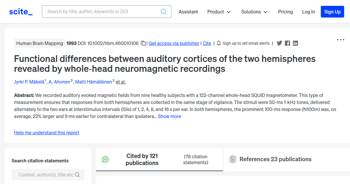 Functional differences between auditory cortices of the two hemispheres ... Functional differences between auditory cortices of the two hemispheres ...