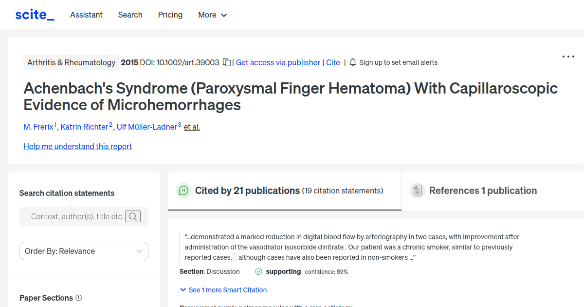 Achenbach's Syndrome (Paroxysmal Finger Hematoma) With Capillaroscopic ...