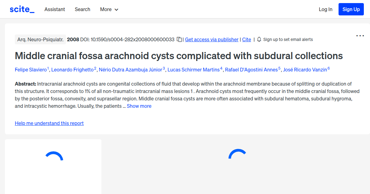 Middle cranial fossa arachnoid cysts complicated with subdural ...