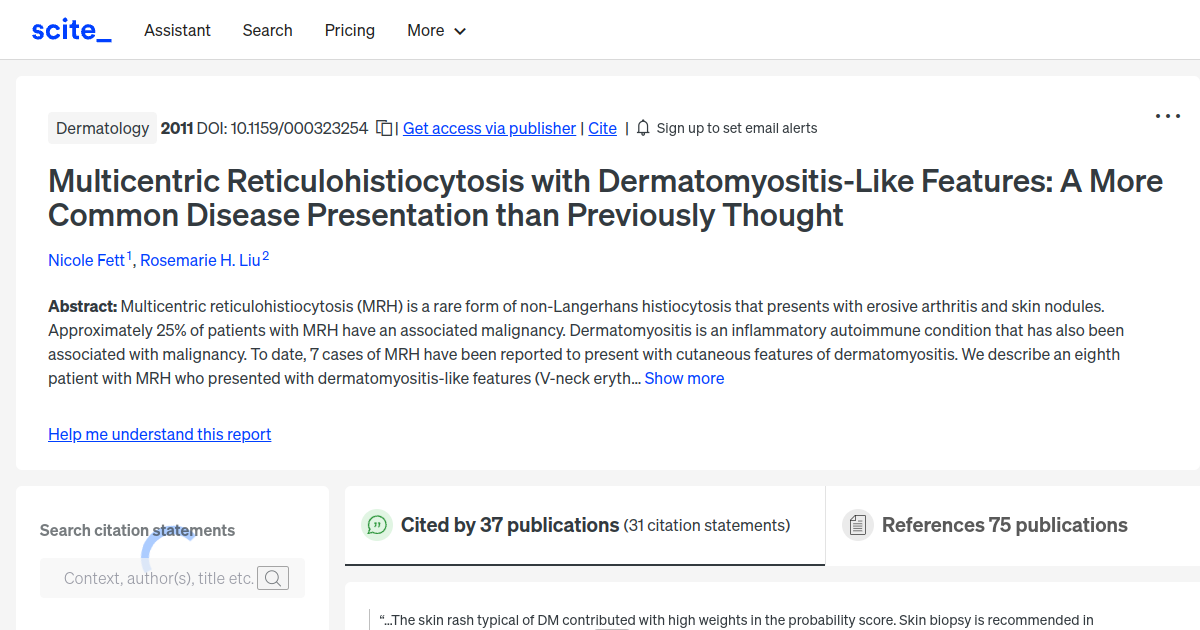 Multicentric Reticulohistiocytosis with Dermatomyositis-Like Features ...