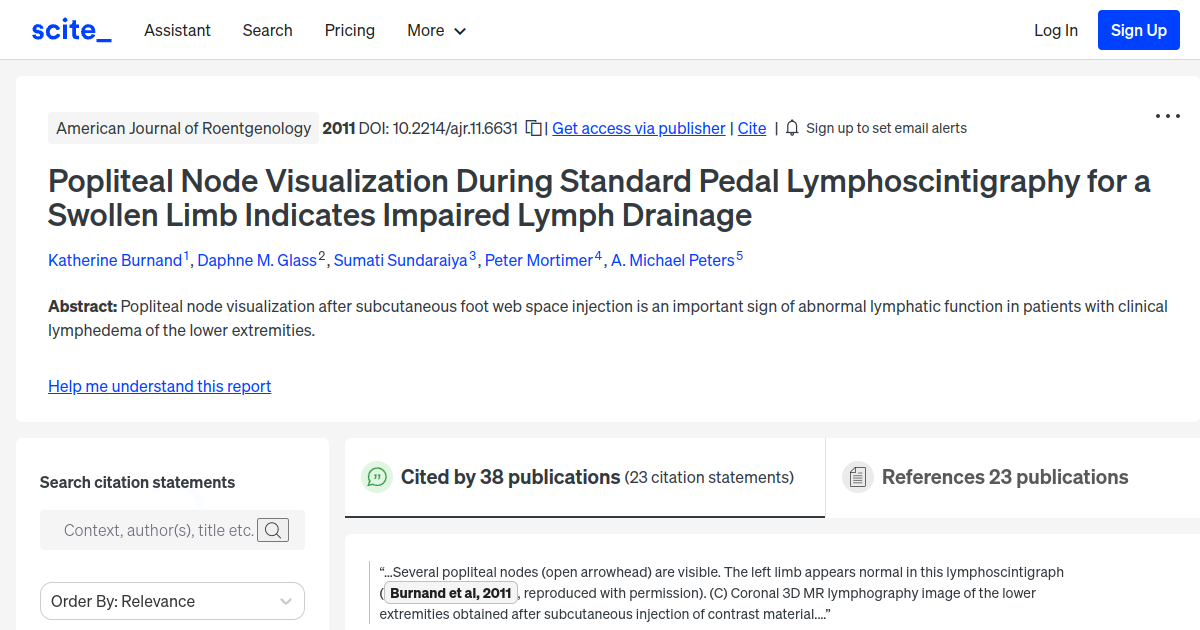 Popliteal Node Visualization During Standard Pedal Lymphoscintigraphy ...