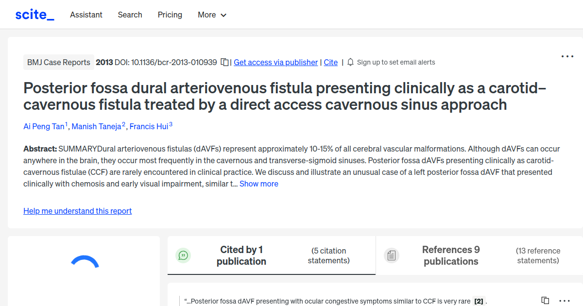 Posterior fossa dural arteriovenous fistula presenting clinically as a ...